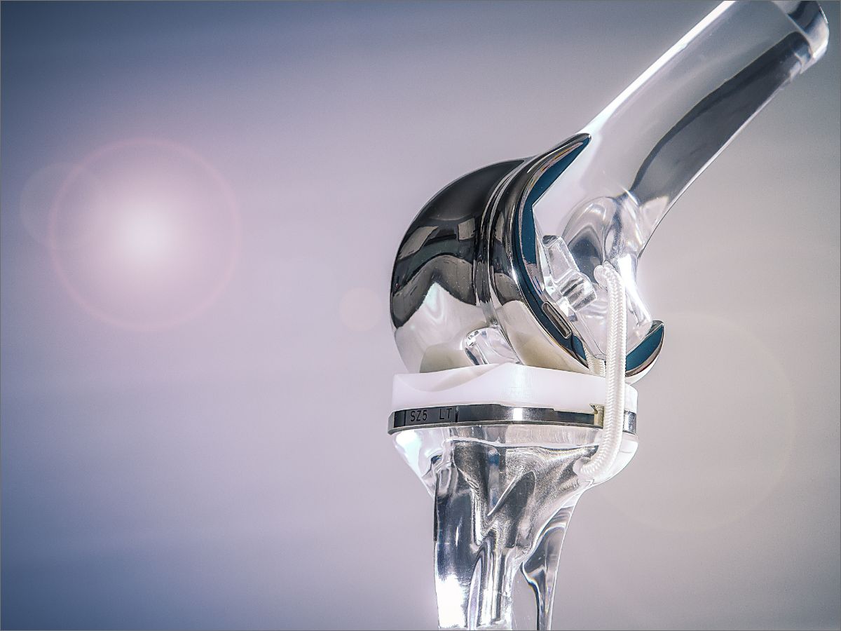 Robotic Total Knee Arthroplasty - Los Angeles, CA - Dr. Jason Snibbe